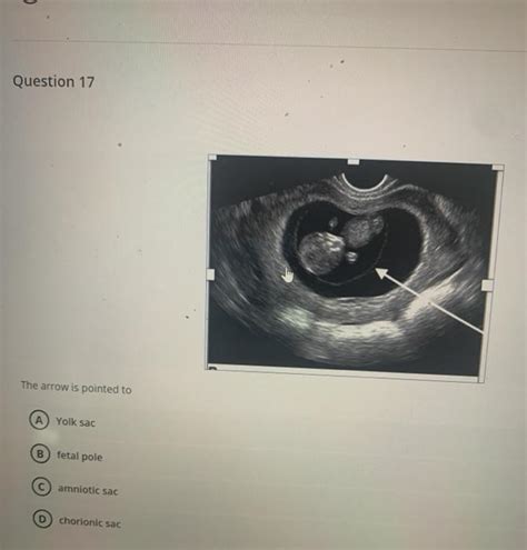 Solved Question LMP Means A Last Day Of The Last Menstrual Chegg Com