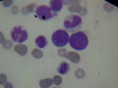 Proeritroblasto Eritroblasto Basofilico Samsung Digital Flickr