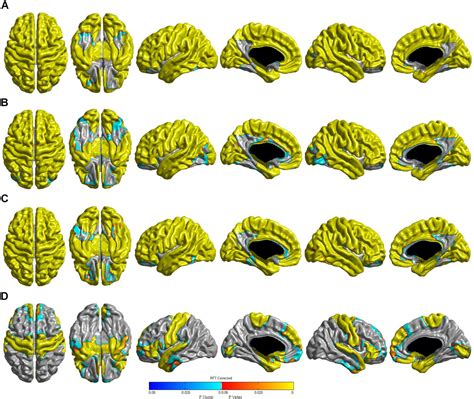 Frontiers Distinct Brain Regions In Physiological And Pathological