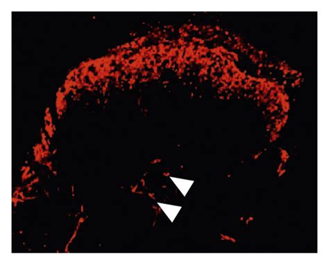Representative Photographs Of Cgrp Immunohistochemistry In The Dorsal