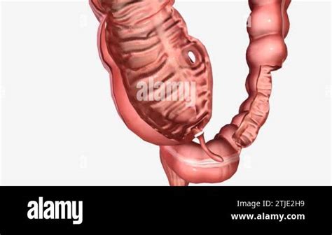 The Cecum Stock Videos And Footage Hd And 4k Video Clips Alamy