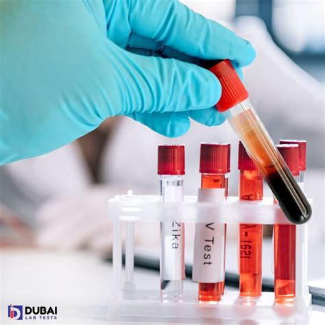 Chlamydia Trachomatis Iga Dubai Lab Tests