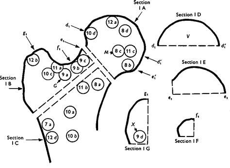 Figure 1 From Scanning Electron Microscope Studies Of Trabecular Bone