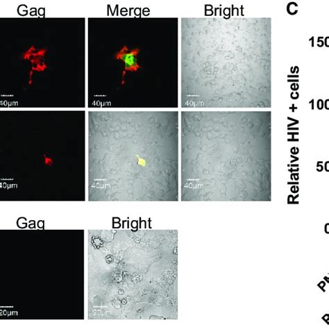Hiv Derived From Placental Tissue Explants Has Expanded Cell Tropism Ex
