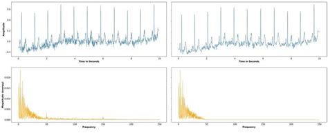 Spectrogram For Ecg Id 1 Lead I Unfiltered Vs Filtered Signal
