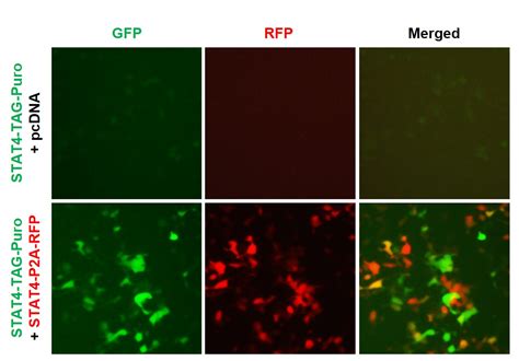 Stat4 Reporter Lipexogen Biotech