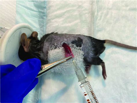 Intrasplenic Injection Of Cancer Cells Splenic Distensionpaling Should