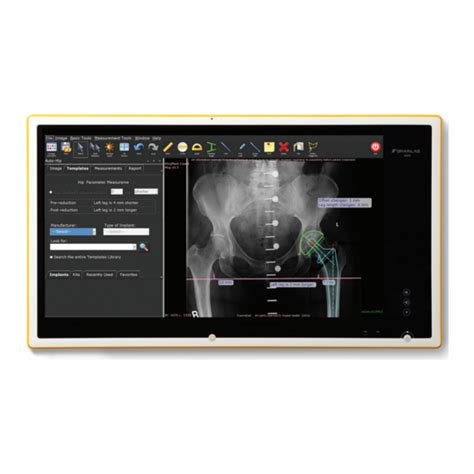 BRAINLAB BUZZ NAVIGATION SYSTEM AND TECHNICAL USER MANUAL Pdf Download ManualsLib