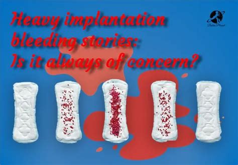What Does Implantation Bleeding Look Like On A Pad