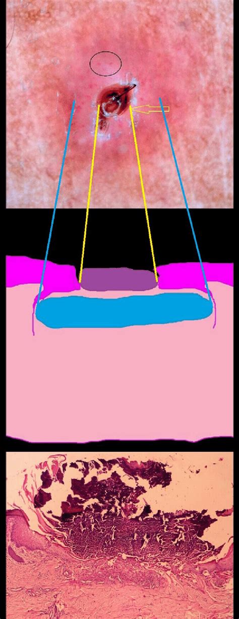 Image Depicting Correlation Of Dermoscopic Patterns With Download Scientific Diagram