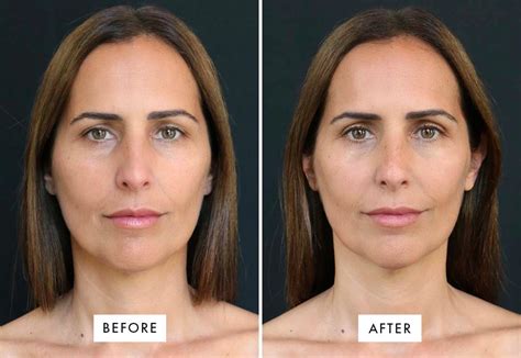 Face Lifting Massage Benefits At Georgia Jarman Blog