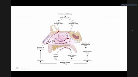 Recurrent Epistaxis Case Study Youtube