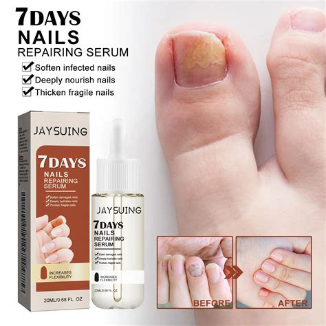 U-as-7-Days-Nail-Growth-Serum-Nourishing-Strength-Care-Essence ...