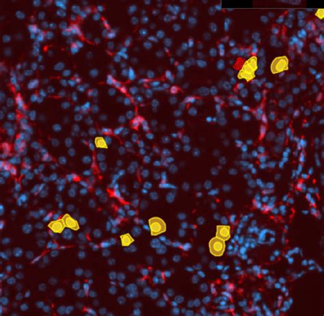 Exporting Measurements For Specific Classes Of Detections Only In