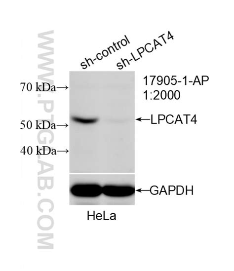 Lpcat4 Antibody 17905 1 Ap Proteintech