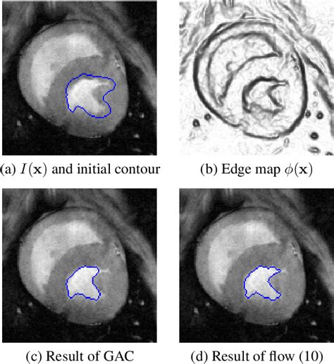 Figure 3 From Directional Geodesic Active Contours Semantic Scholar