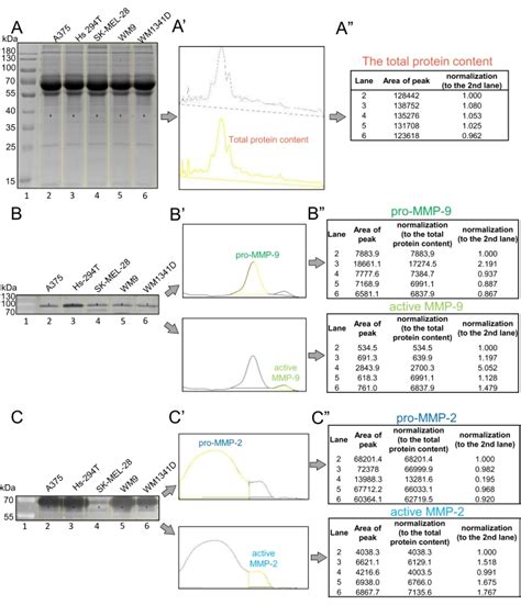 Zymography Assay