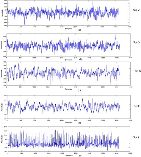 Automated Diagnosis Of Epileptic Seizures Using Eeg Image