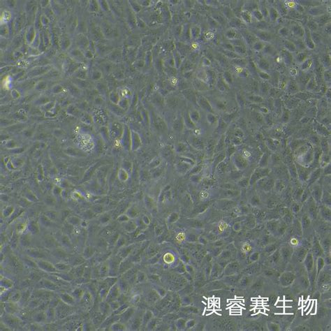 Huv Ec C [huvec]（人脐静脉血管内皮细胞） 报价 价格 性能参数 图 澳培赛生物 生物器材网