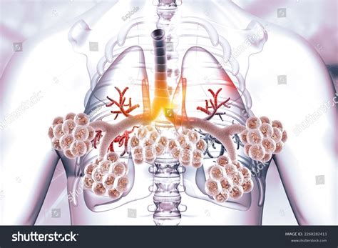 Human Lung Alveoli Anatomy 3d Illustration Stock Illustration 2268282413 Shutterstock