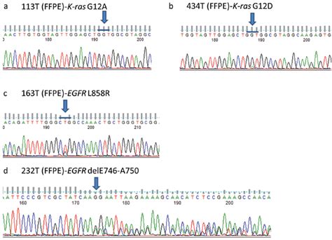 Mutation Screening In Formalin Fixed Paraffin Embedded Ffpe Samples Download Scientific