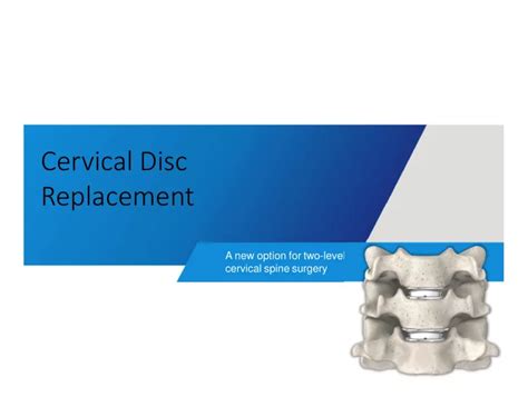 [ppt] Cervical Disc Replacement A New Option For Two Level Cervical Powerpoint Presentation