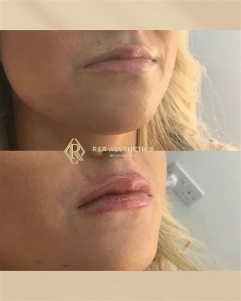 Randr Aesthetics There Are Very Few Things That Feel As