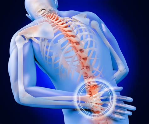 Kyphoplasty Effective Treatment For Spine Compression Fractures