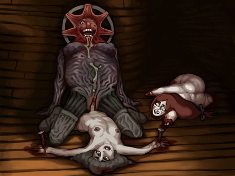 Rule 34 Abella Fear And Hunger Amputation Amputee Deadheadmoth