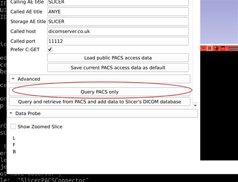 Clicking On Query PACS Only With Default Value Reports Failed To Establish Association
