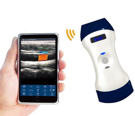 Usg Abdomen Cardiac 3 In 1 Probe Portable Wireless Ultrasound Scanner