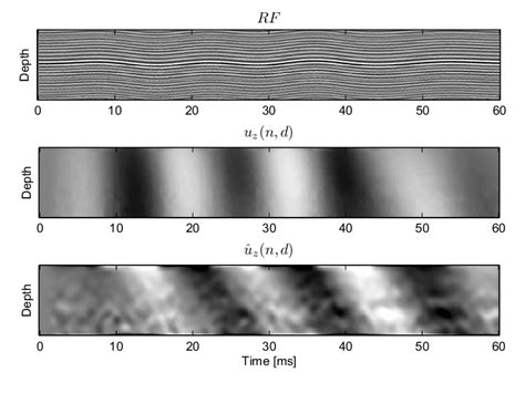 Experimental Setup Used For Quantitative Validation The Actuator Was Download Scientific