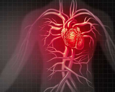 Dyslipidemia What Is Dyslipidemia