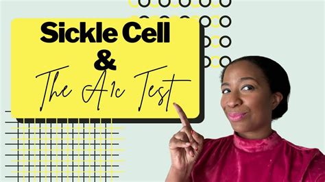 Sickle Cell And The A1c Test Youtube