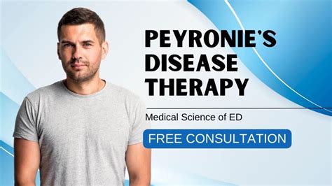 Address Peyronies Disease With Noninvasive Shockwave Therapy Ed Treatment Ny