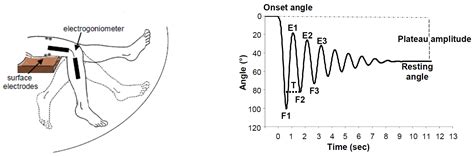 applicability of the instrumented pendulum test for assessing limb viscoelastic properties in