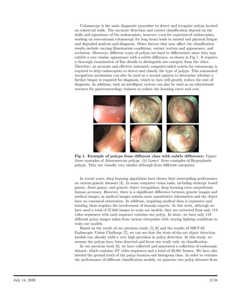 A Comparative Study On Polyp Classification Using Convolutional Neural Networks DeepAI