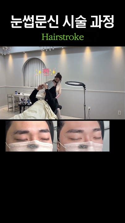 이전에 받은 눈썹문신으로 생긴 잔흔까지 커버시술 Youtube