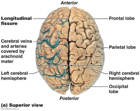 What Is Transverse Cerebral Fisure Qnhv