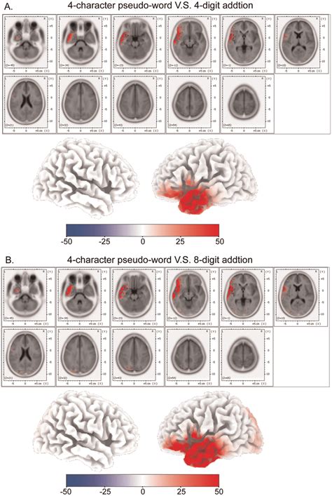 Source Localization Of P2 Component A Sloreta Results Of The