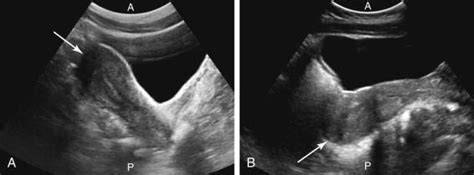 Pelvis And Uterus Clinical Tree