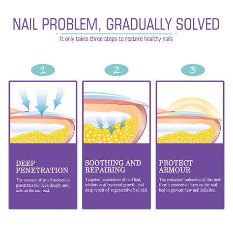 Jaysuing Nail Fungus Products 7 Days Treatment Spray