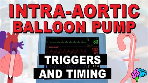 balloon pump timing and triggering iabp youtube