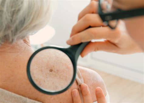 Team Dermis Hautklinik