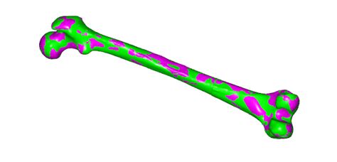 Personalize Model Based On CT Data By Nickel Lee Main Forum AnyScript Forum