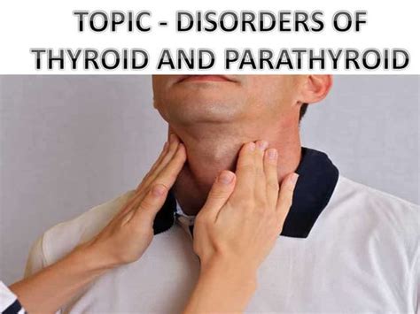 Thyroid Swelling Etiology Pathogenesis Pptx