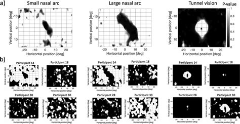 Differential Fixation Density Maps Showing The Distribution Of P