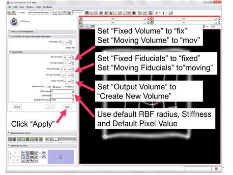 Ppt Using Plastimatch For Landmark Based Registration Powerpoint