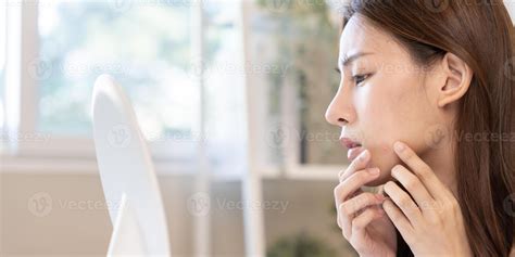 Young Women Are Worry About Faces Dermatology And Allergic To Steroids