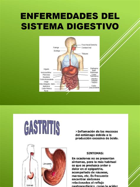 Enfermedades Del Sistema Digestivo Pdf Diarrea Aspirina